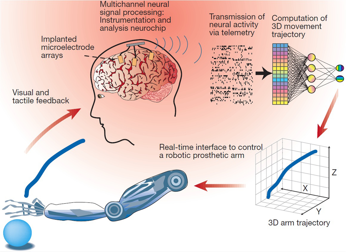 Chinese Scientists Successfully Develop Brain-Computer Interface ...